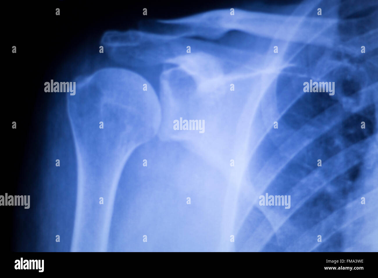 Spine vertebra ribs back injury vertebral column medical x-ray test ...