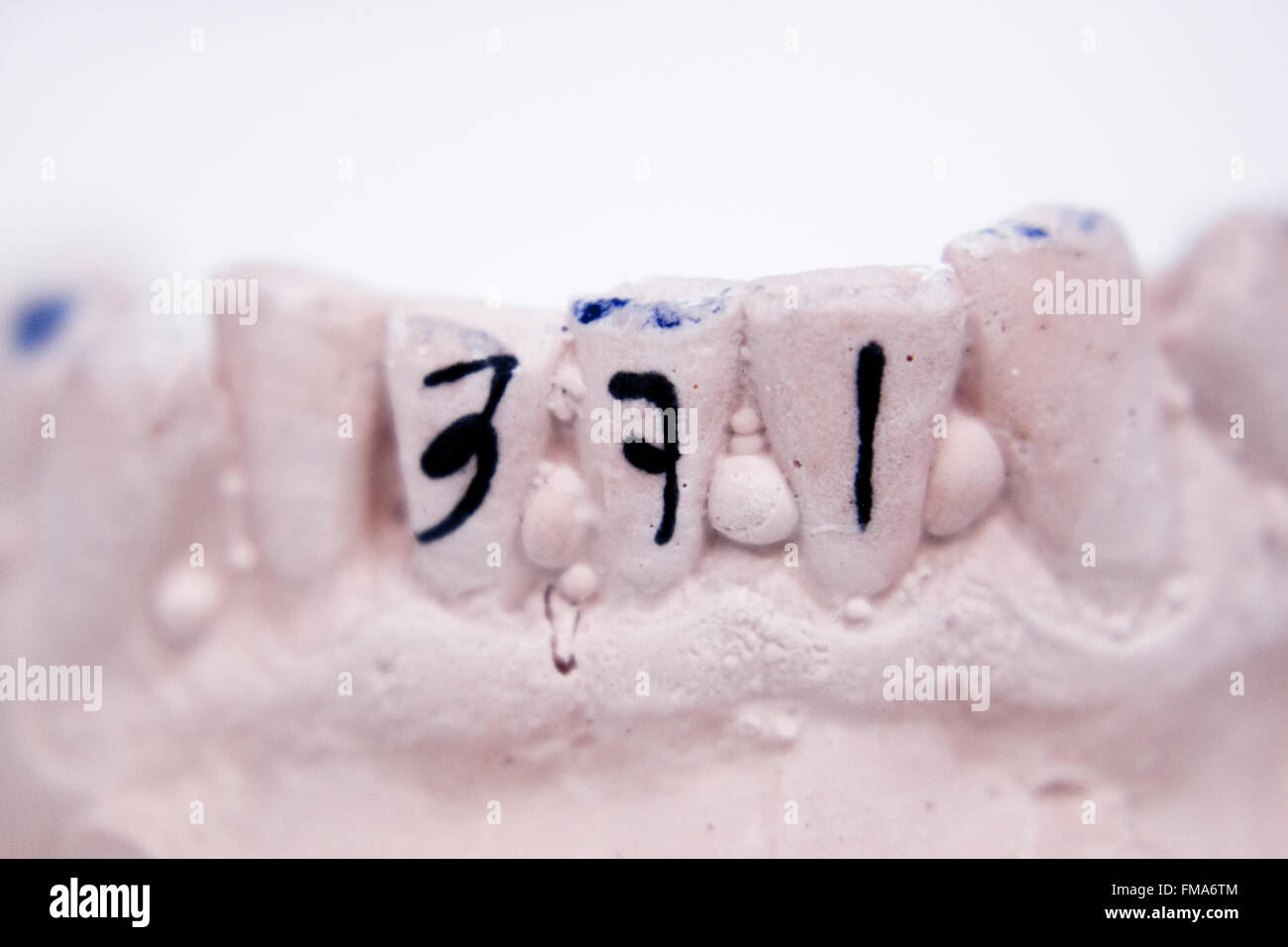 Dental prosthetics clay tooth mold in dentists laboratory photo Stock ...