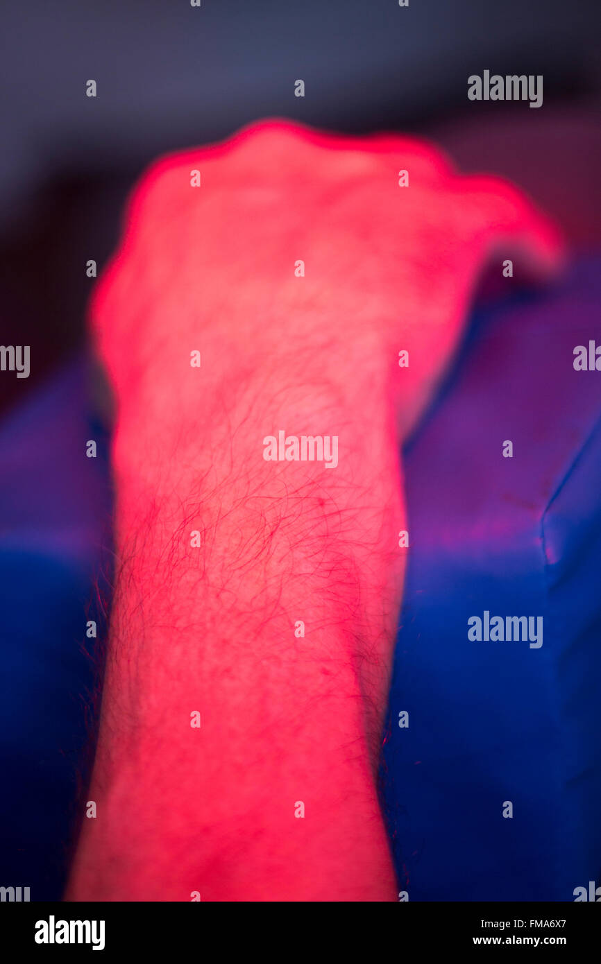 Physical therapy clinic of hospital. Patient having heat lamp ...