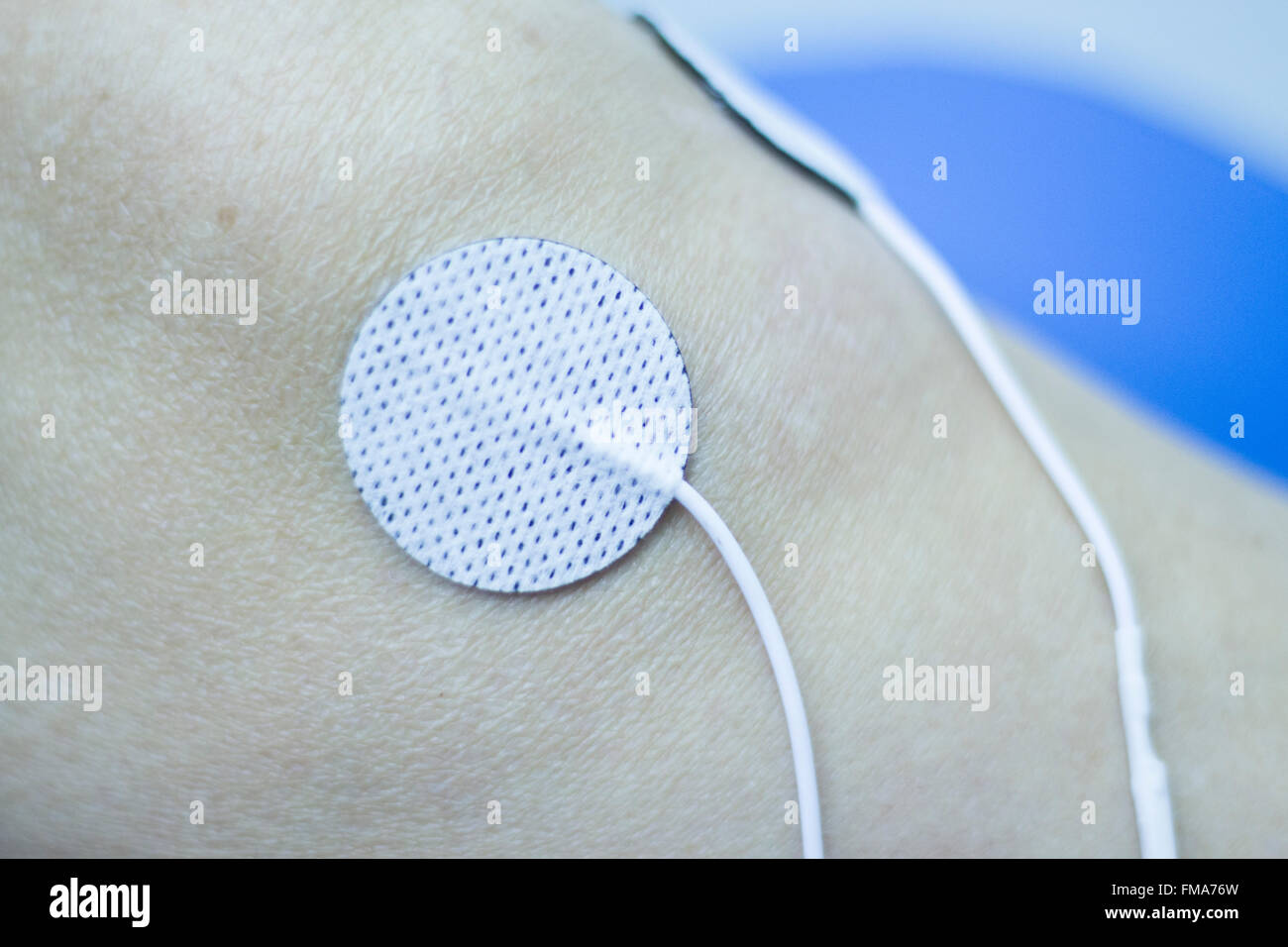 Physical therapy clinic of hospital. Patient having electrical impulse ...