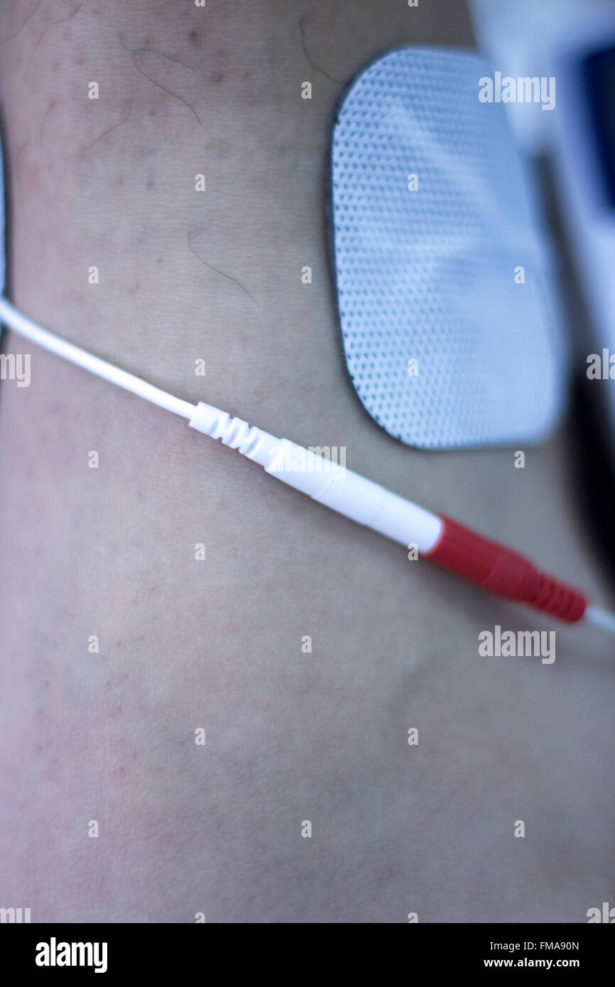 Physical therapy clinic of hospital. Patient having electrical impulse ...