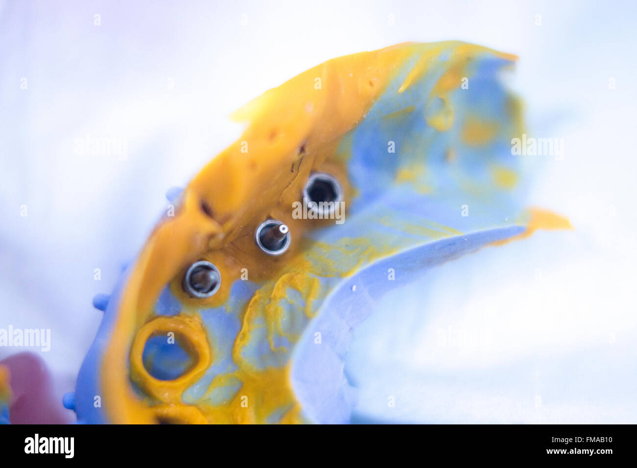 Dental mold dental impression plate in dentist's clinic Stock Photo - Alamy