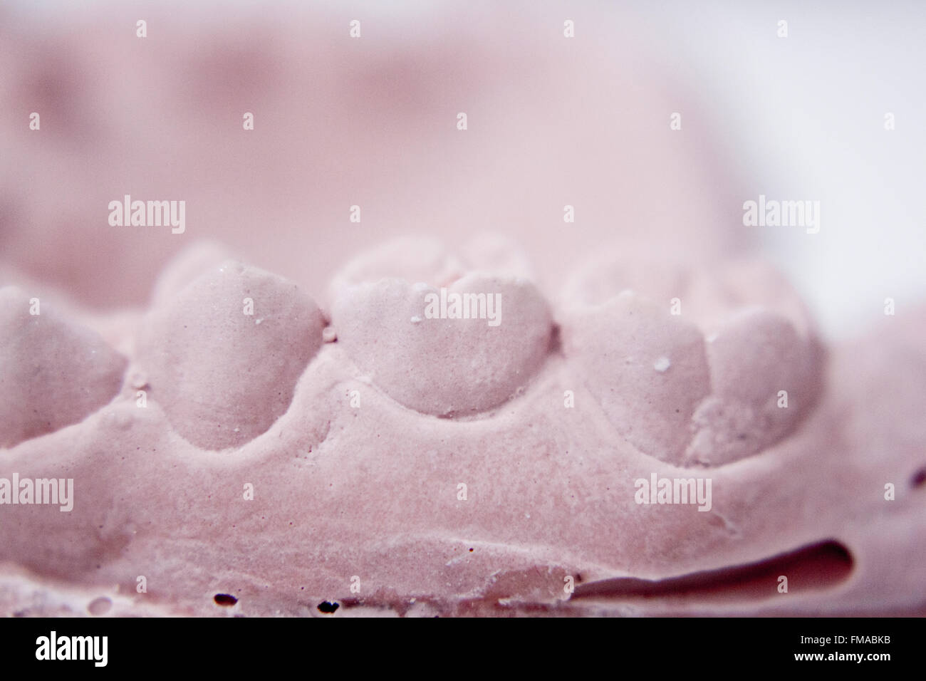 Dental prosthetics clay tooth mold in dentists laboratory photo Stock ...