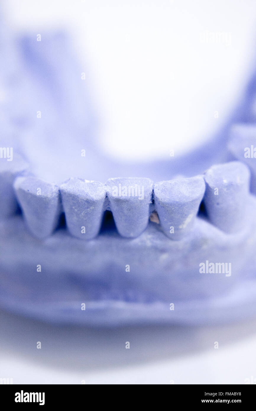 Dental prosthetics clay tooth mold in dentists laboratory photo Stock ...