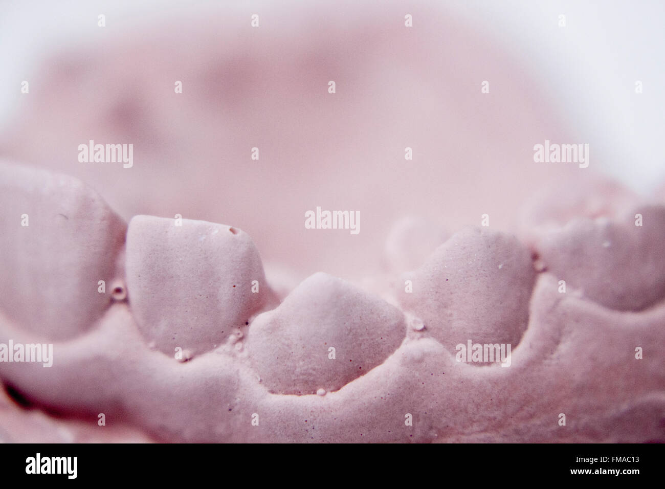 Dental prosthetics clay tooth mold in dentists laboratory photo Stock ...