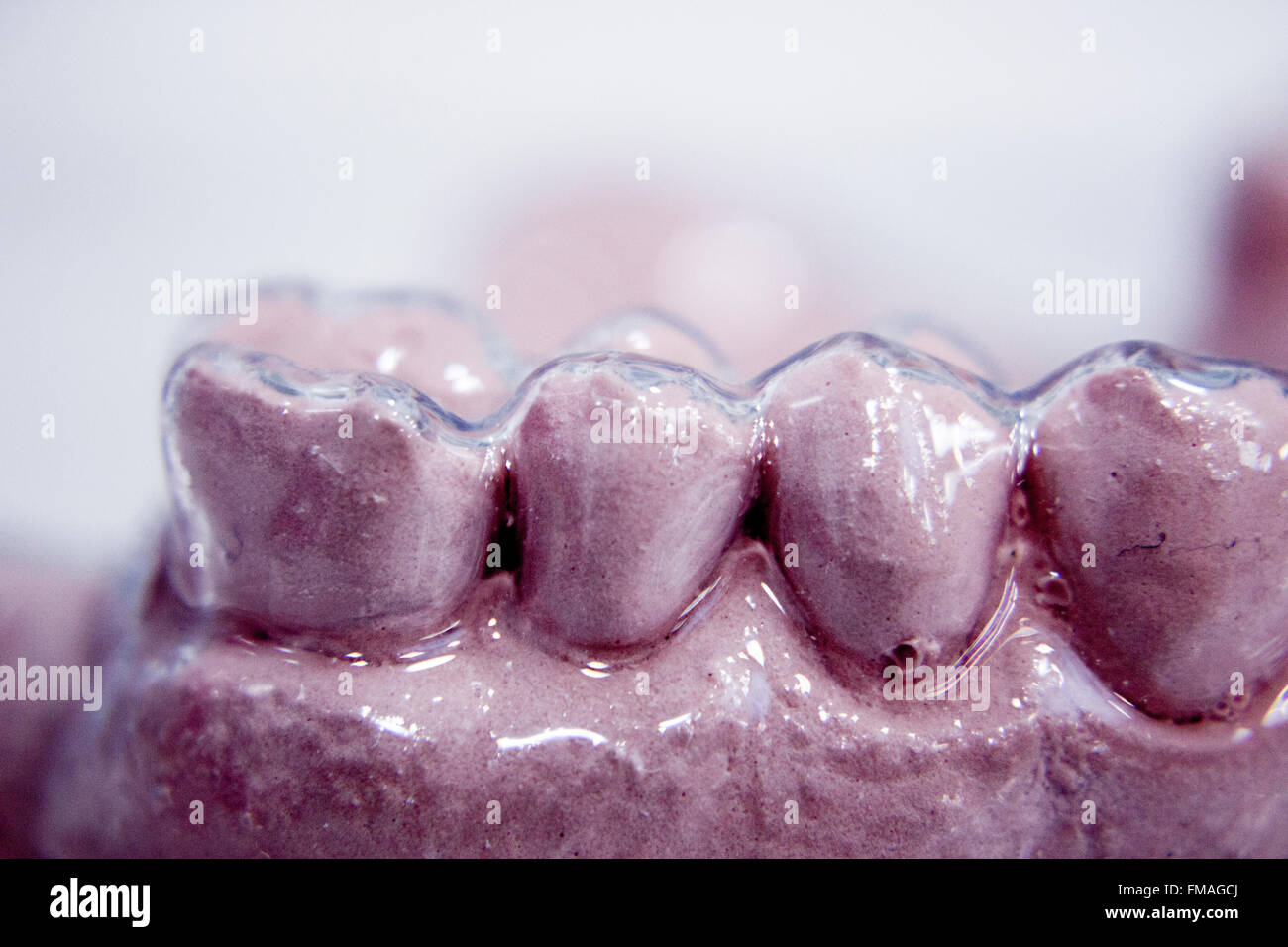 Dental prosthetics clay tooth mold in dentists laboratory in plastic ...