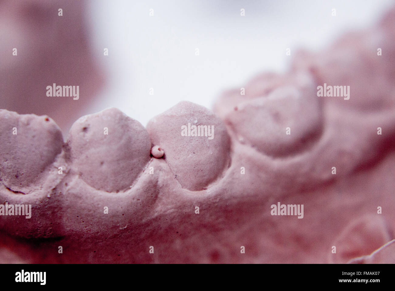 Dental prosthetics clay tooth mold in dentists laboratory photo Stock ...