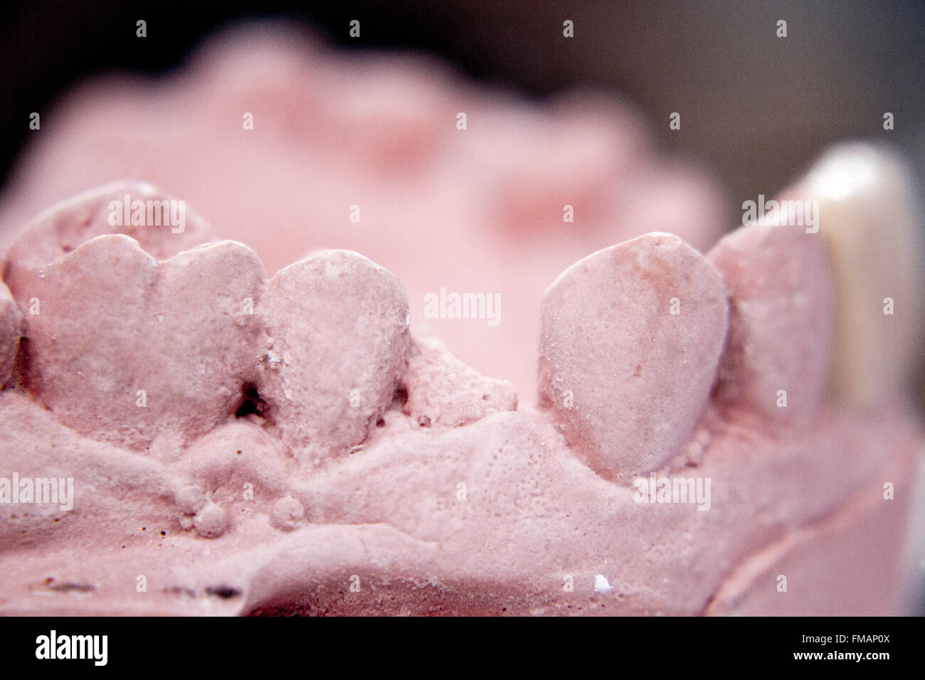 Dental prosthetics clay tooth mold in dentists laboratory photo Stock ...