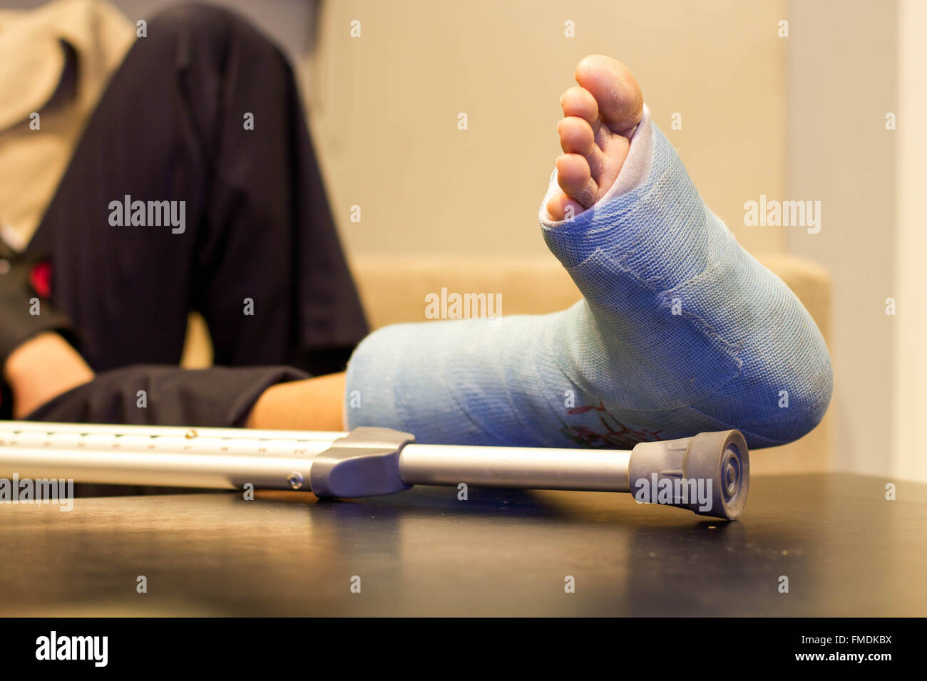 Fractured Ankle Bones High Resolution Stock Photography and Images - Alamy
