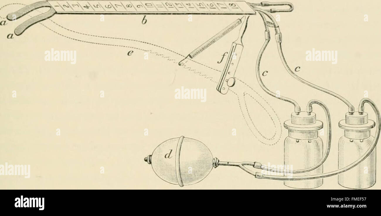 *Operative Surgery* (1899) offers a comprehensive guide on surgical ...