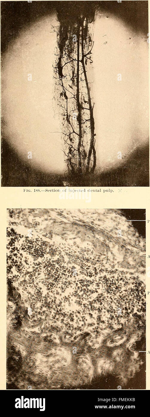 The 1901 text on operative dentistry covers essential dental procedures ...