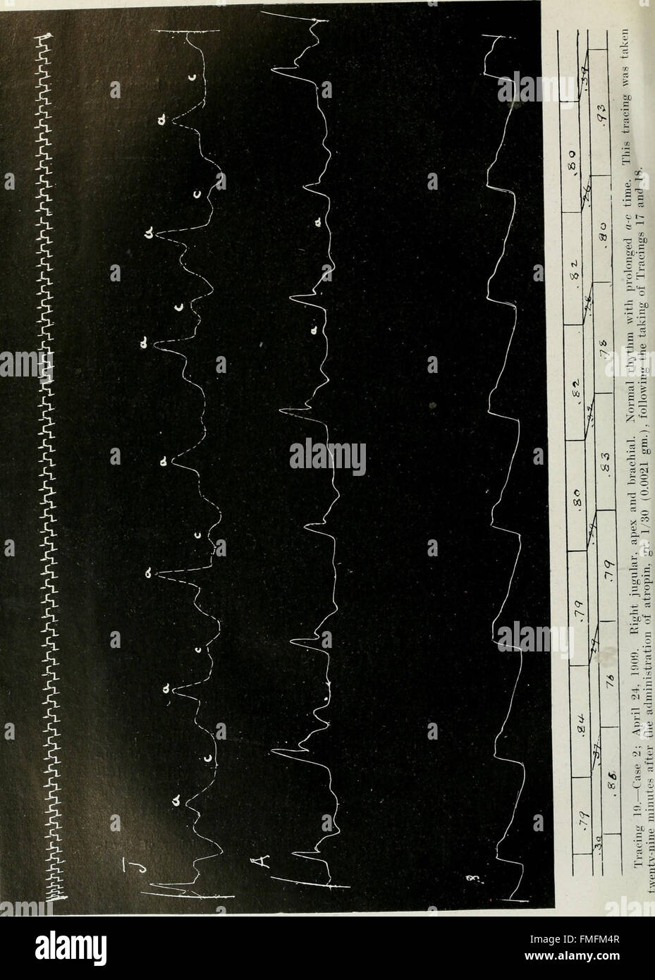 The 'Archives of Internal Medicine' (1908) is a historical medical ...