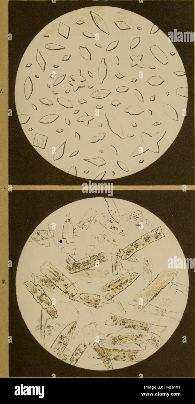 The 'Atlas der physiologischen und pathologischen Harnsedimente' (1871 ...