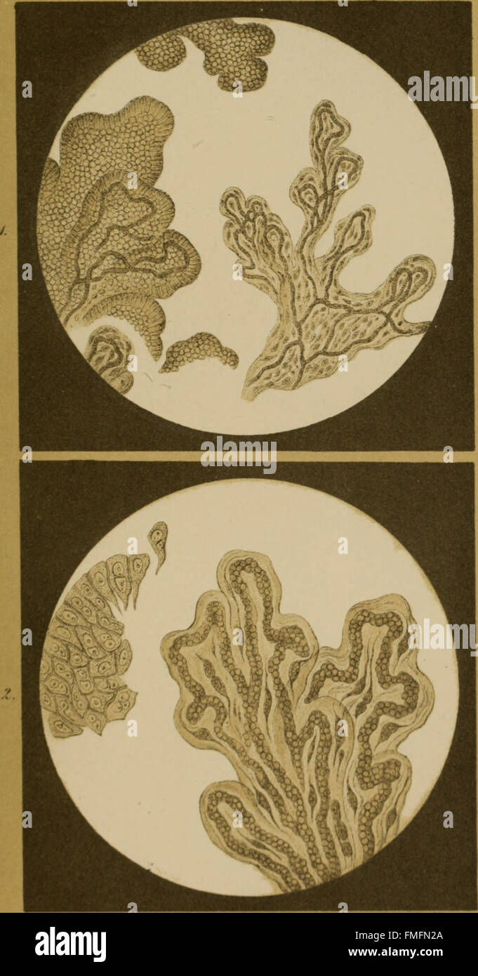 'Atlas der physiologischen und pathologischen Harnsedimente' (1871 ...