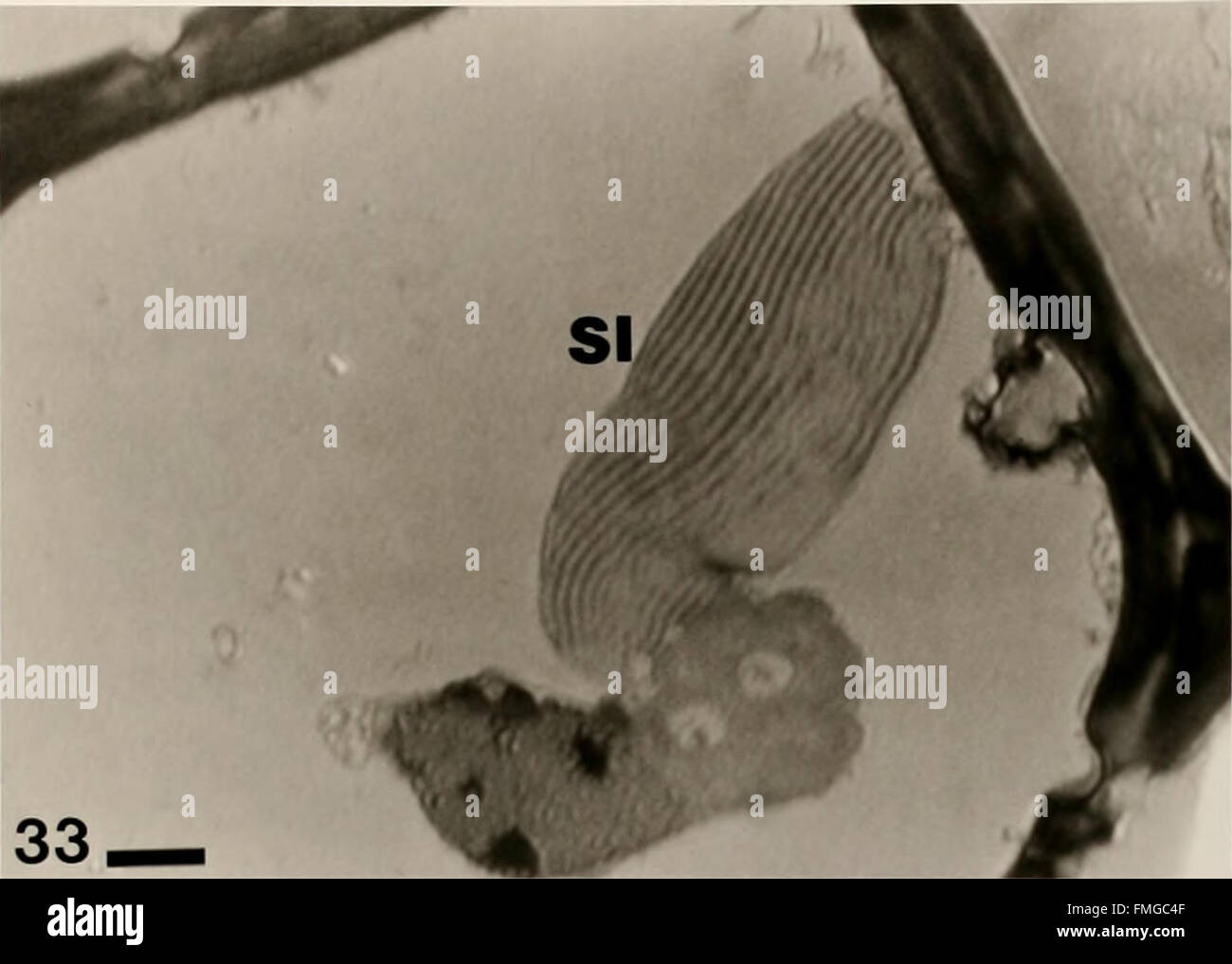 Identify pathogens hi-res stock photography and images - Alamy