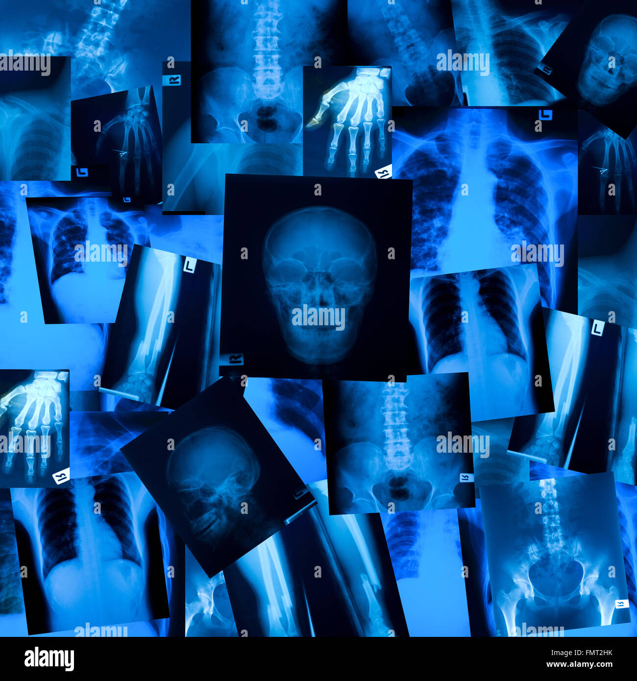 X ray film background Stock Photo - Alamy