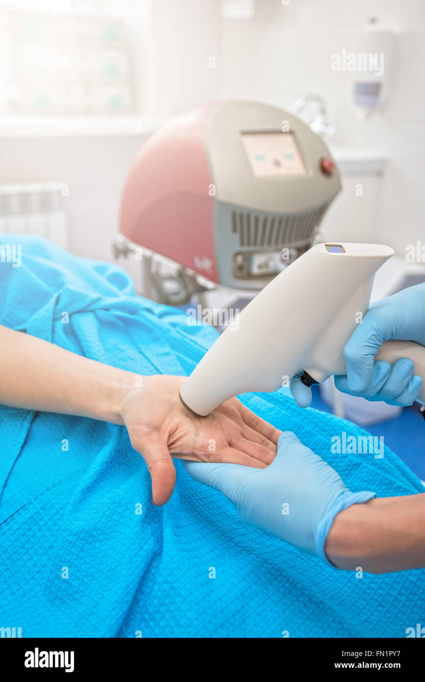 Procedure against hyperhidrosis Stock Photo - Alamy