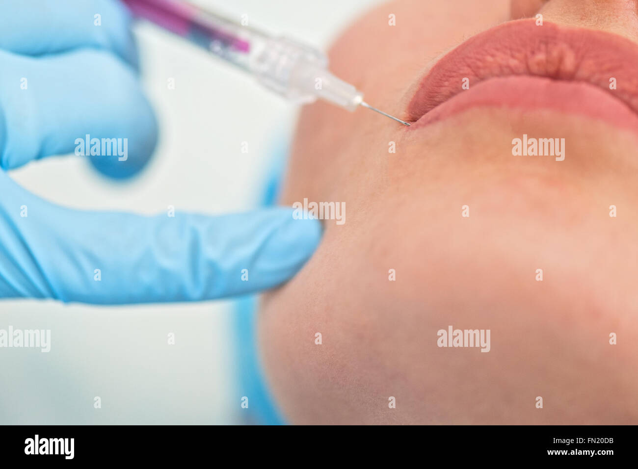 woman gets injection in her lips Stock Photo - Alamy