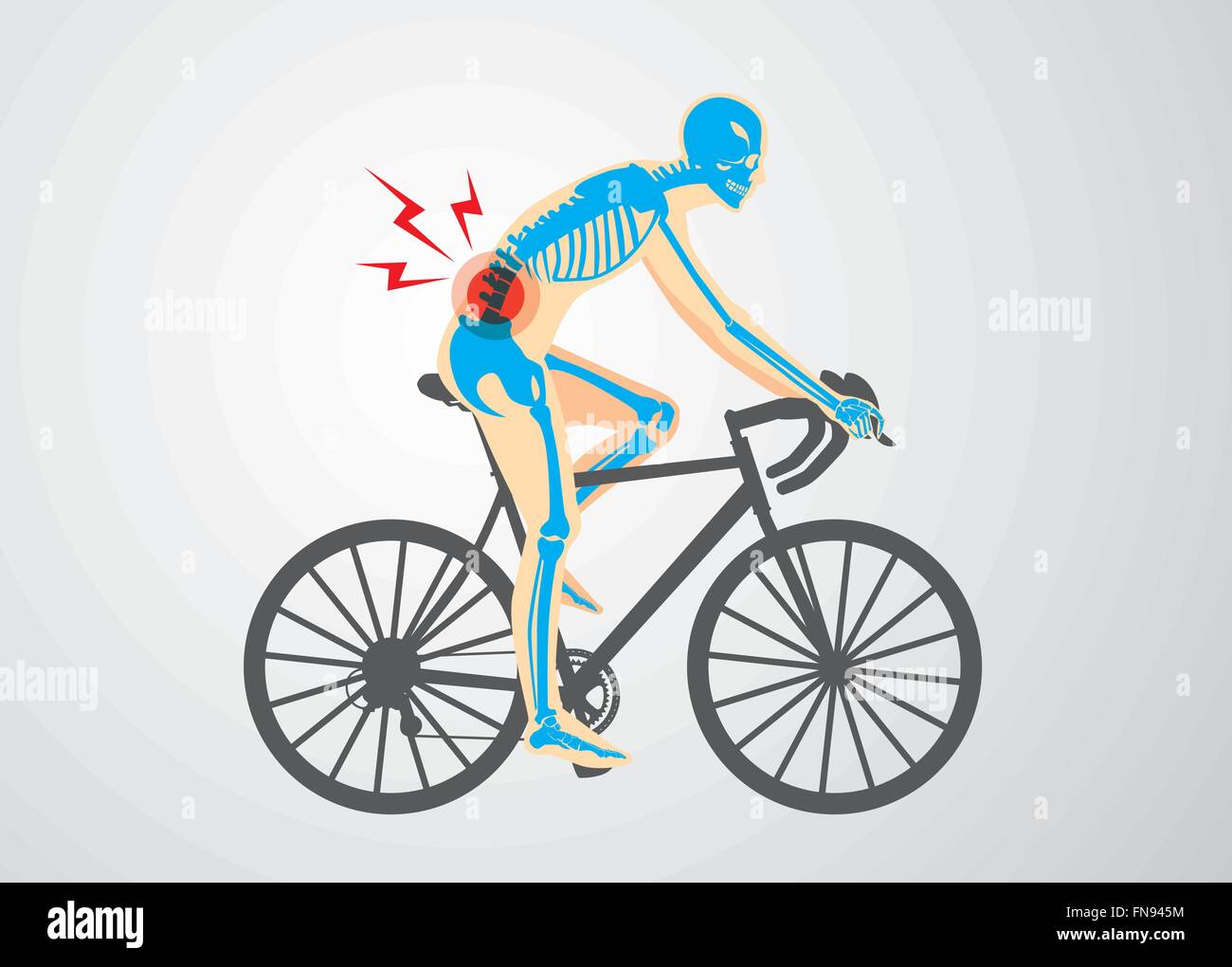 Spine inflammation illustration hi-res stock photography and images - Alamy