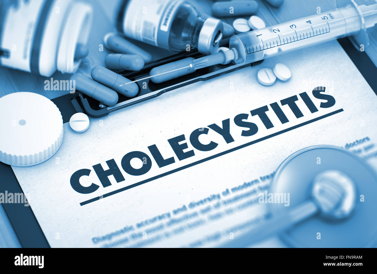 Cholecystitis Diagnosis. Medical Concept. 3D Stock Photo - Alamy