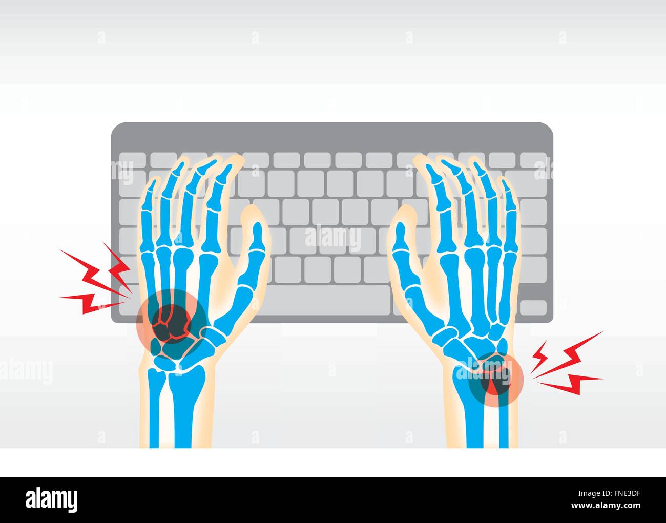 Hand pain from use keyboard Stock Vector Image & Art - Alamy