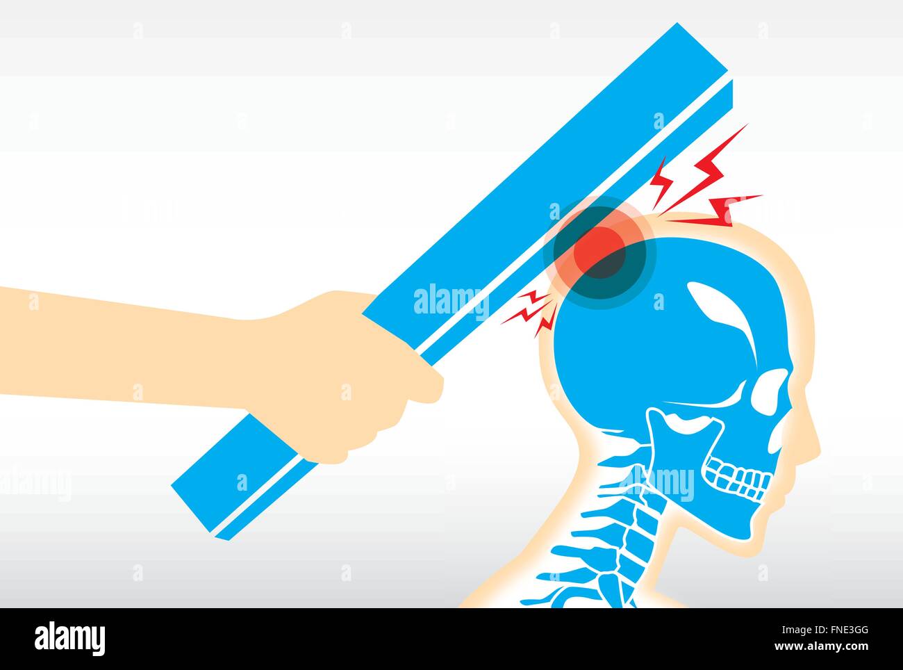 Injured at head from hit Stock Vector Image & Art - Alamy