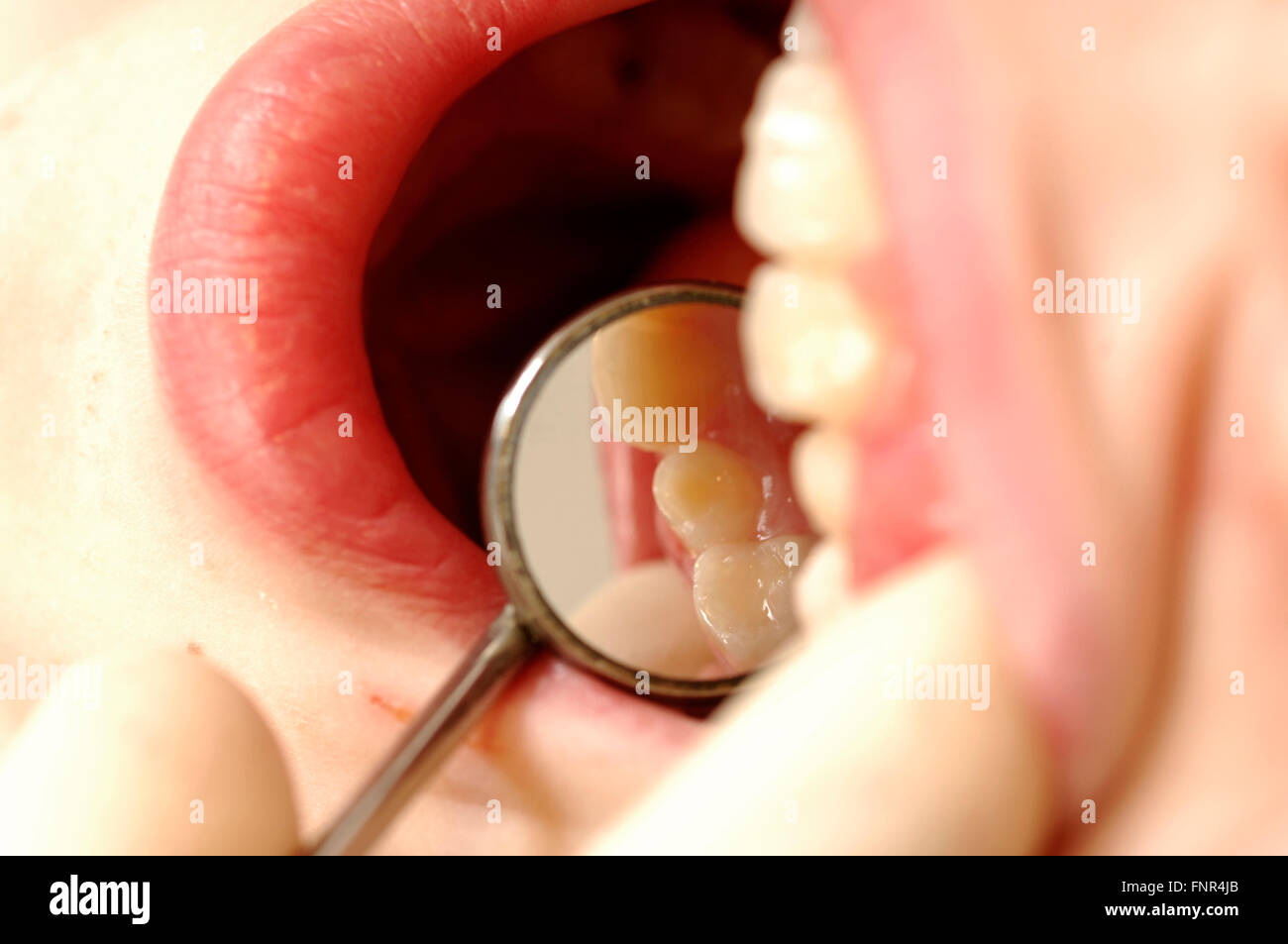 Close up of a dental surgery taking place on a young boy Stock Photo ...