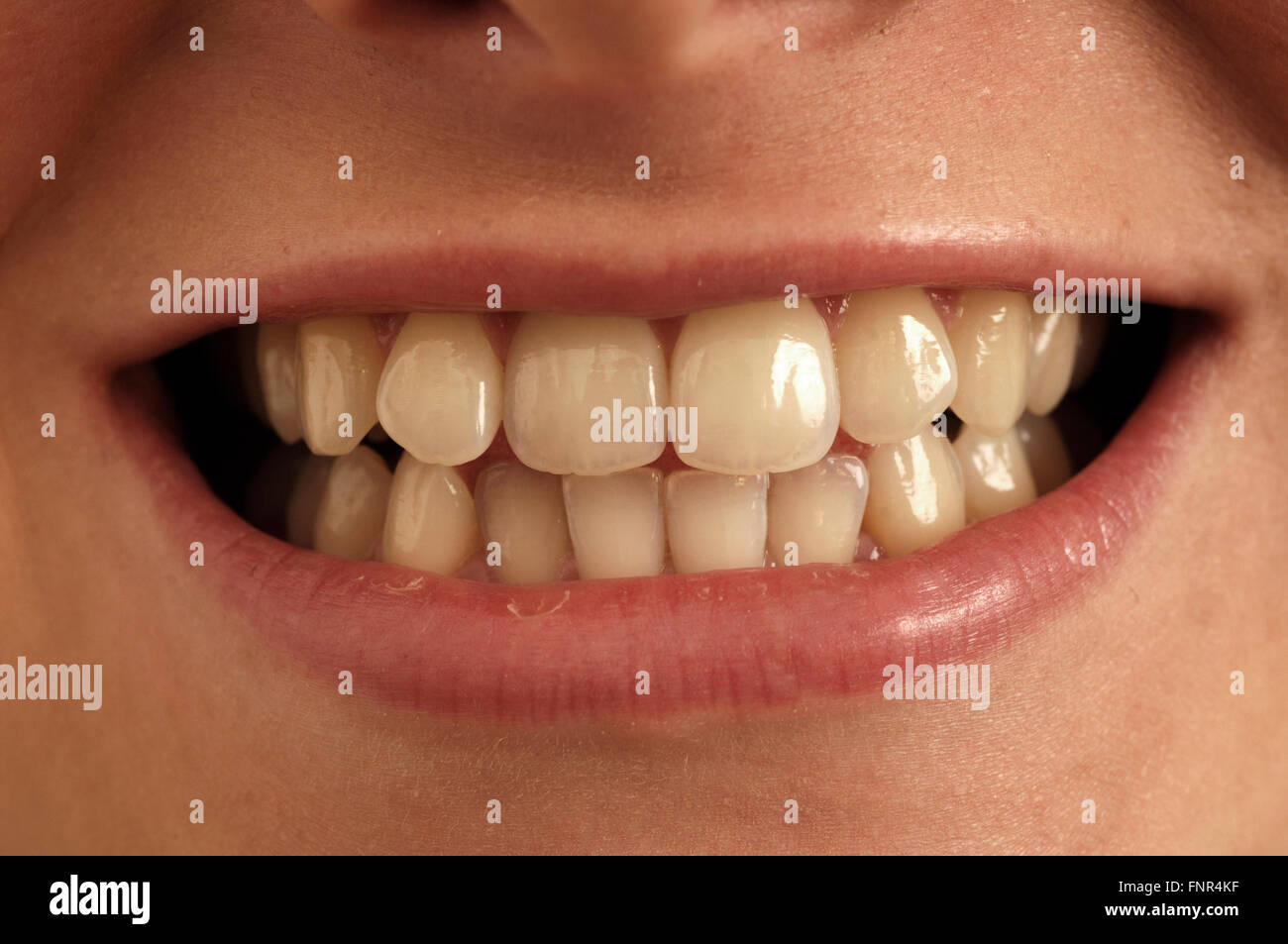 Close up of a young smiling girl showing her front teeth Stock Photo ...