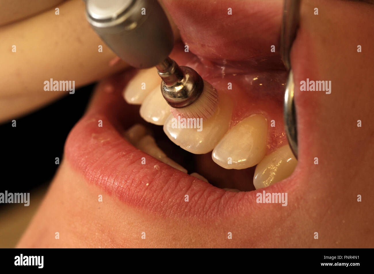 Young boy having his teeth checked and cleaned at the dentist Stock ...
