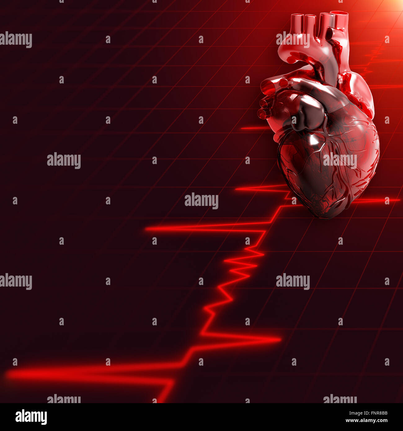 Heart blockage hi-res stock photography and images - Alamy