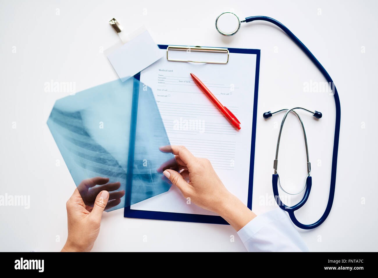 X-ray in radiologist hands over medical objects Stock Photo - Alamy