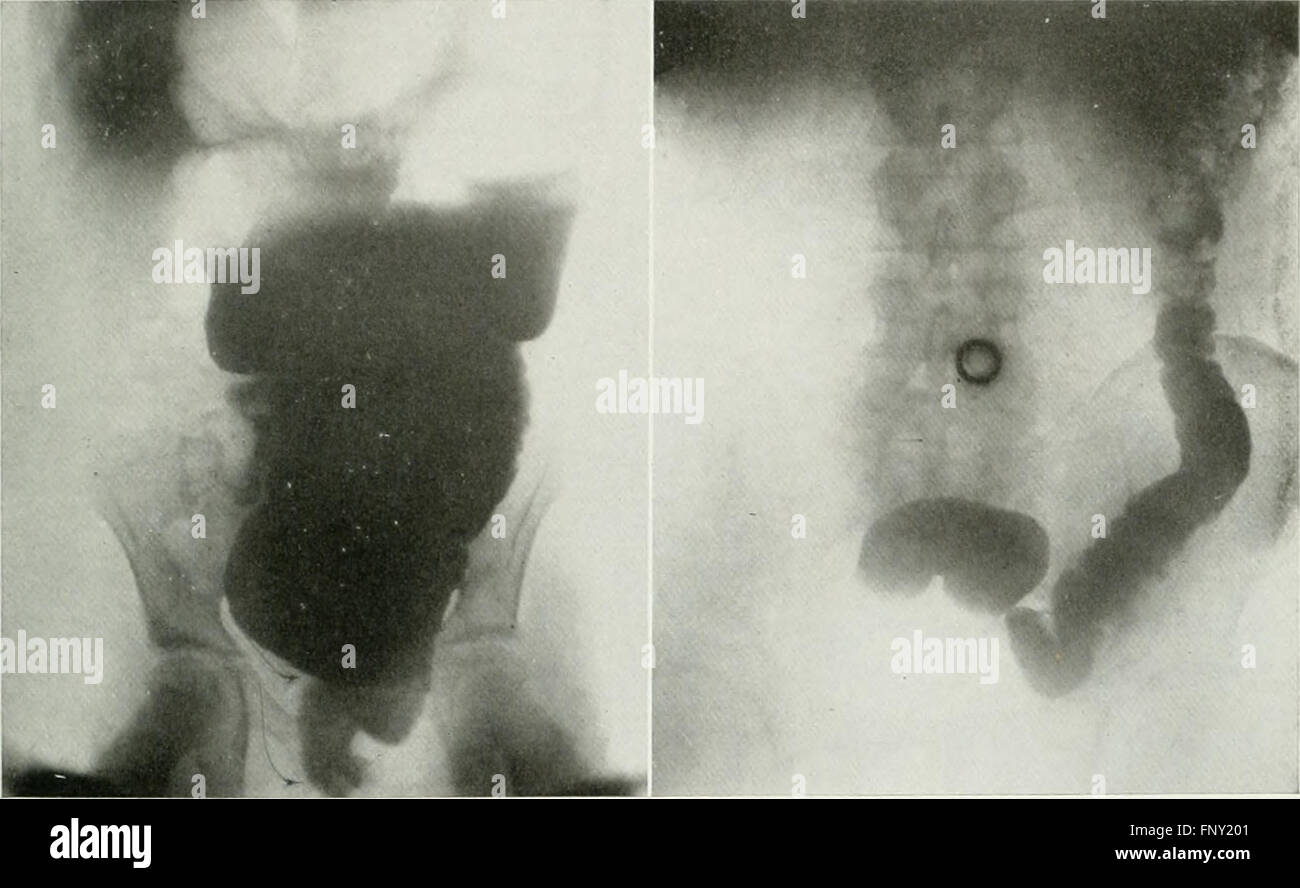 The 1906 edition of this journal covers developments in radiology, including advancements in ...