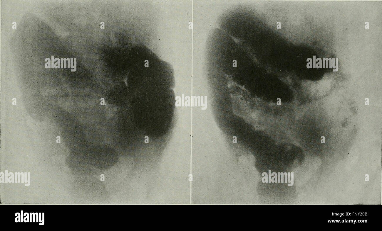 *The American Journal of Roentgenology, Radium Therapy and Nuclear ...