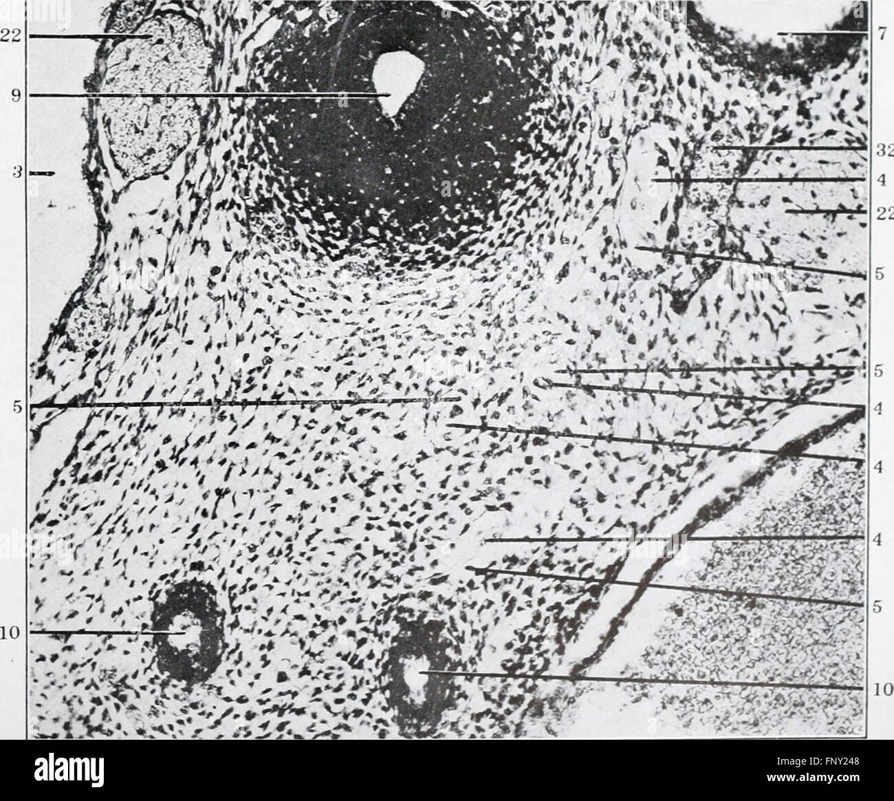 Lymph nodes function hi-res stock photography and images - Alamy