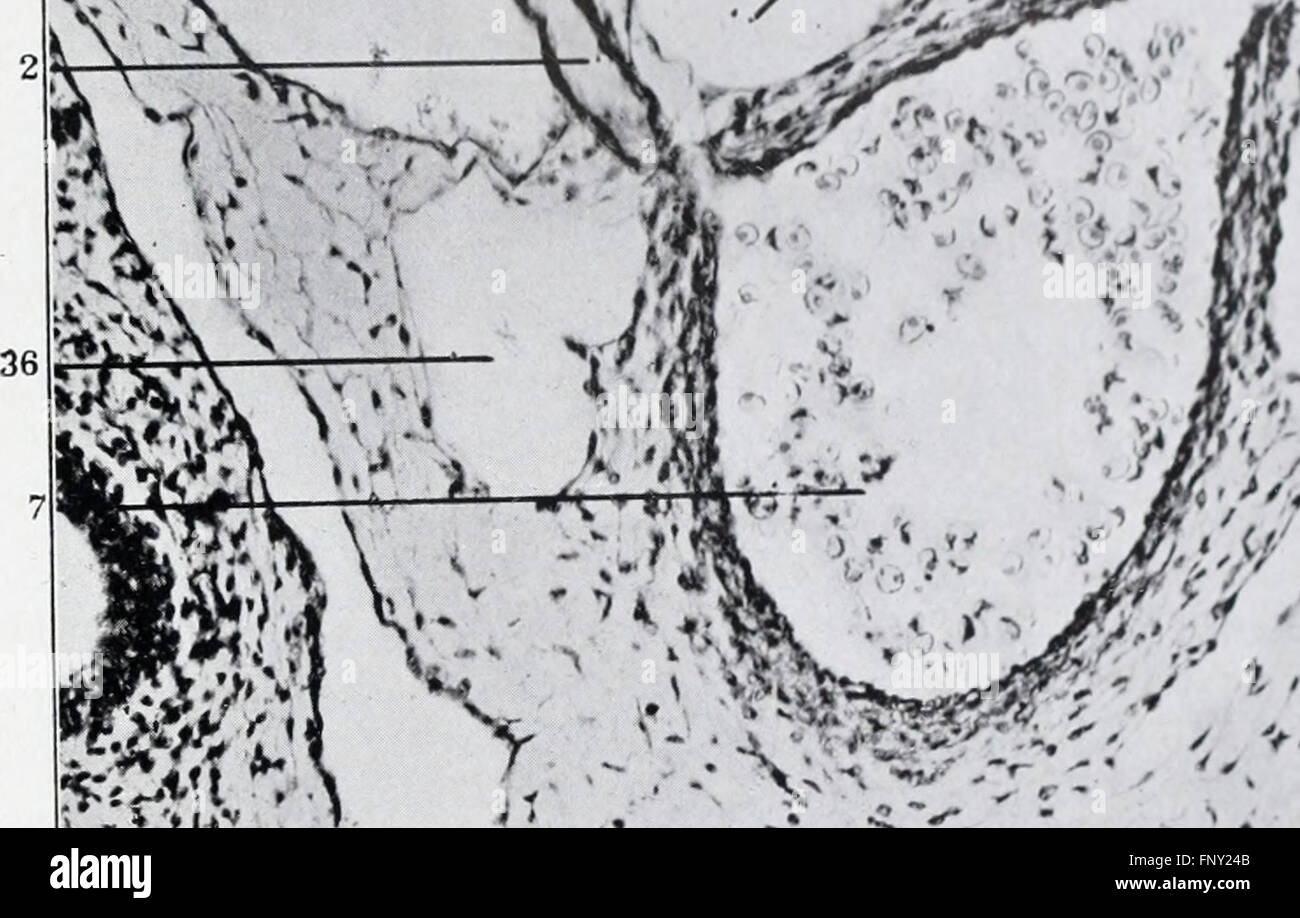 Lymph nodes function hi-res stock photography and images - Alamy