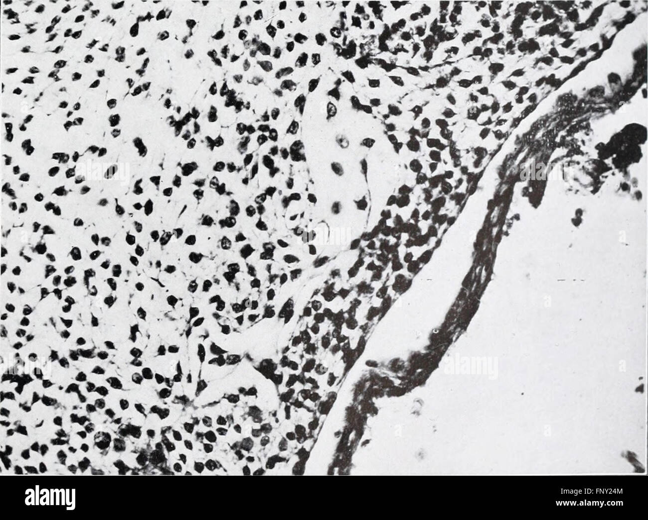 *The Anatomy and Development of the Systemic Lymphatic Vessels in the ...