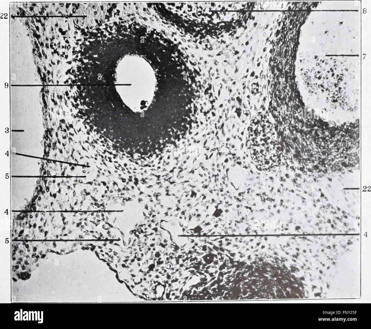 This 1911 work explores the anatomy and development of the lymphatic ...
