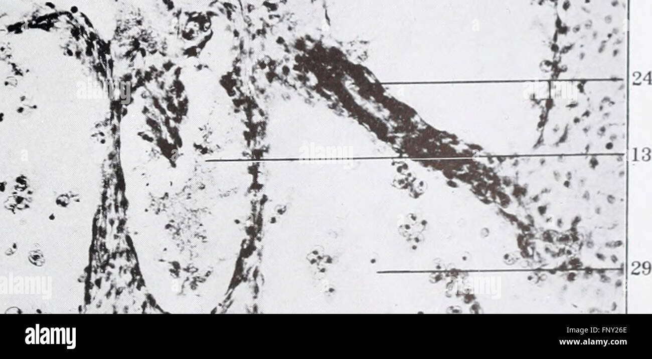 This 1911 study explores the anatomy and development of the lymphatic ...