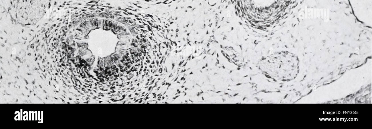 'The Anatomy and Development of the Systemic Lymphatic Vessels in the ...