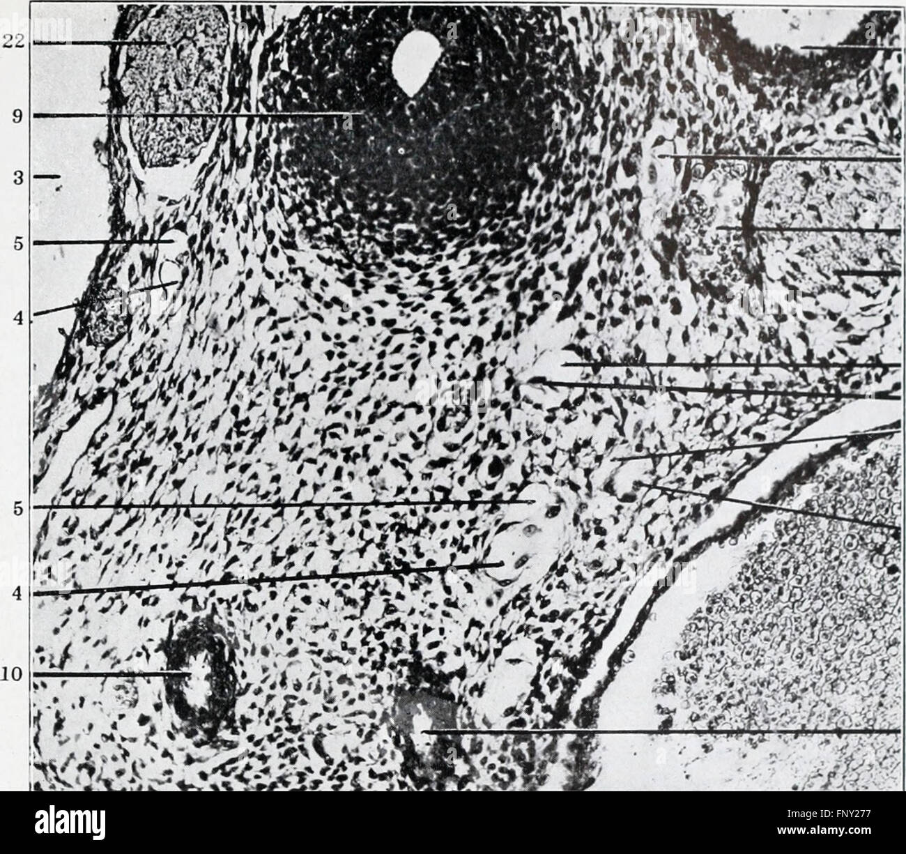 Lymph nodes function hi-res stock photography and images - Alamy