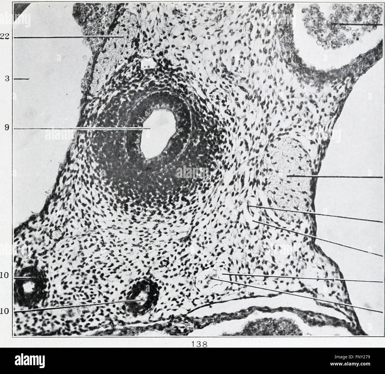 This 1911 study examines the anatomy and development of the lymphatic ...