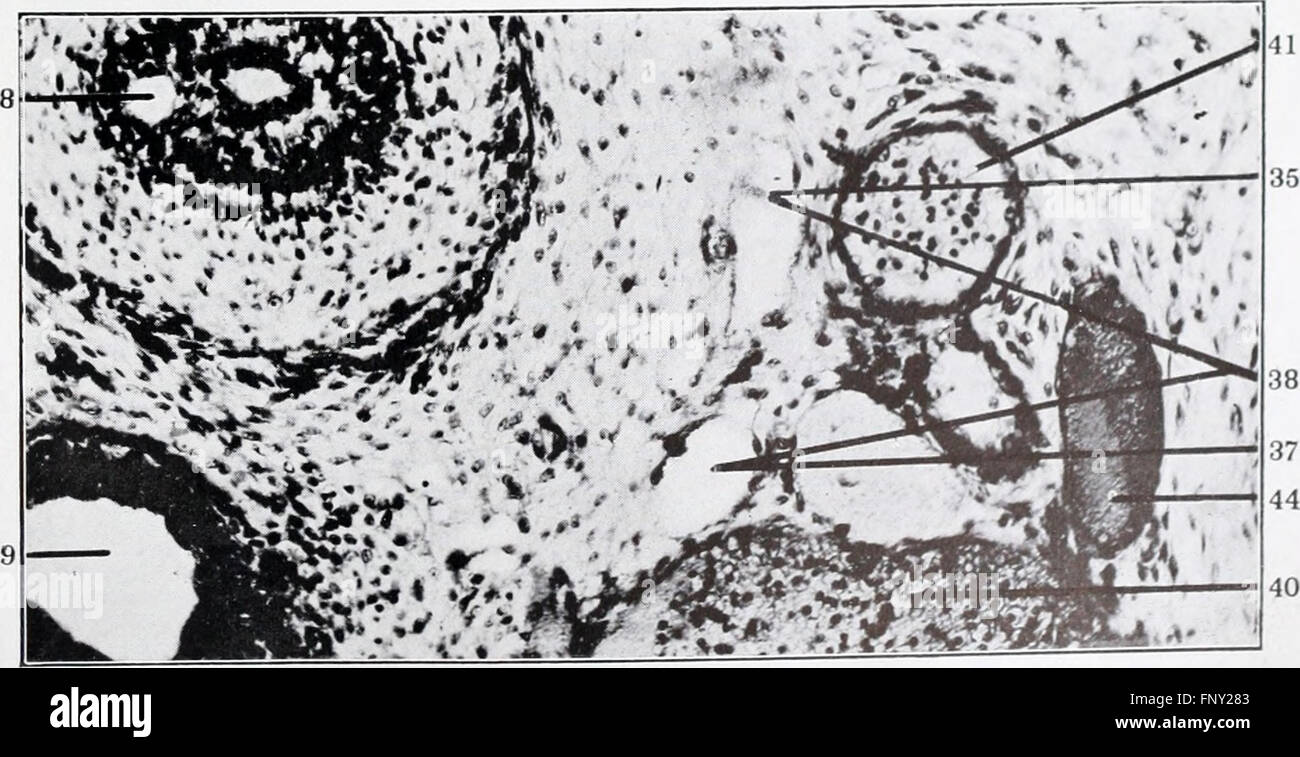 Lymph nodes function hi-res stock photography and images - Alamy