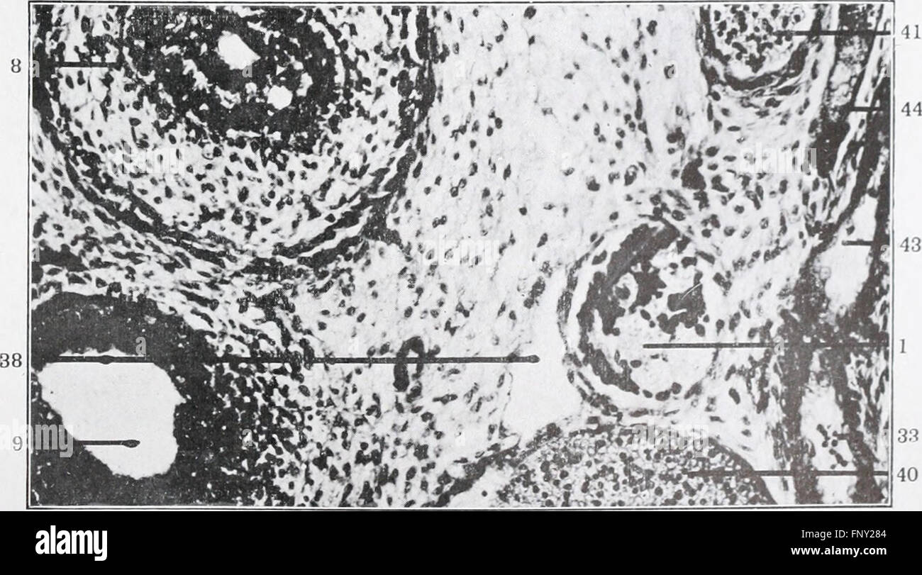 A 1911 study detailing the anatomy and development of the lymphatic ...