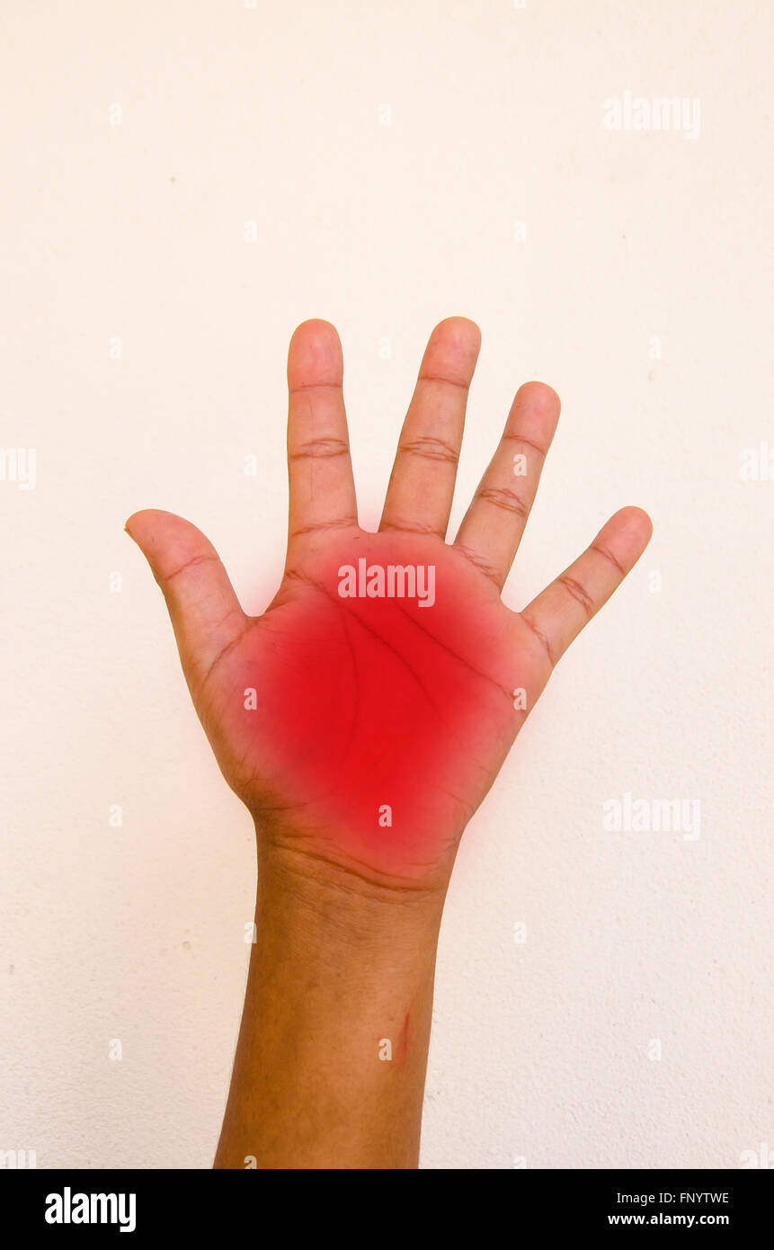 children hand injury on white background Stock Photo - Alamy