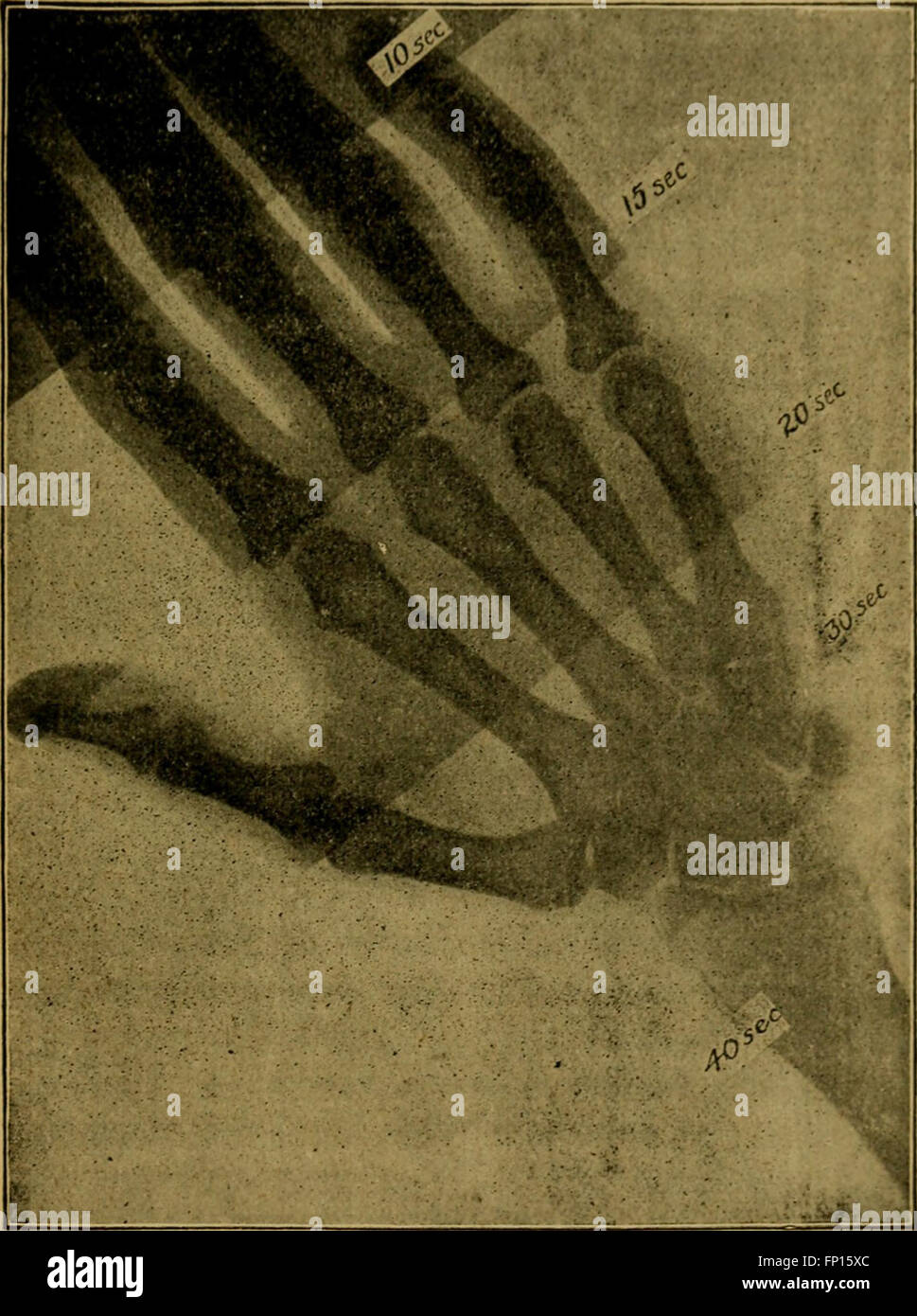 This 1903 handbook offers a clear and accessible explanation of X-rays, their theory, and ...