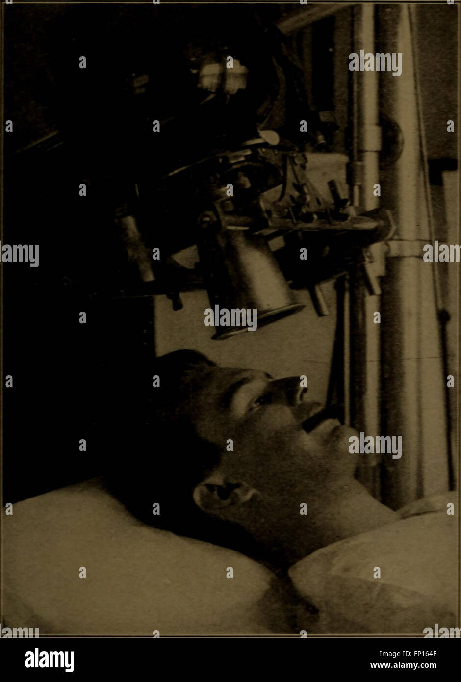 Medical radiation injuries hi-res stock photography and images - Alamy