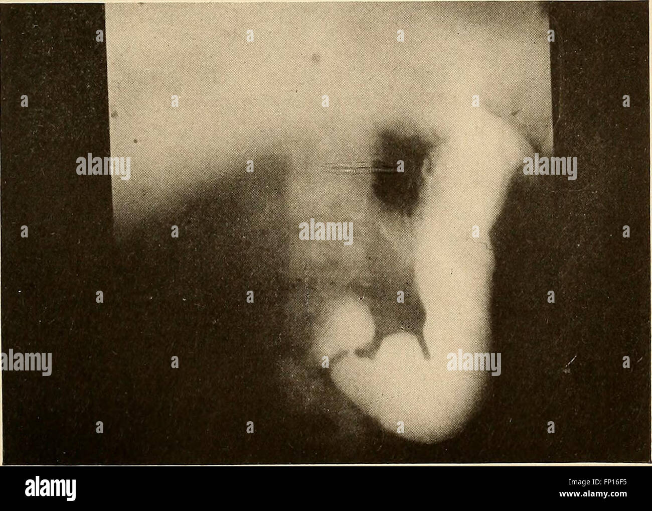 This 1917 manual provides detailed instructions on X-ray techniques ...