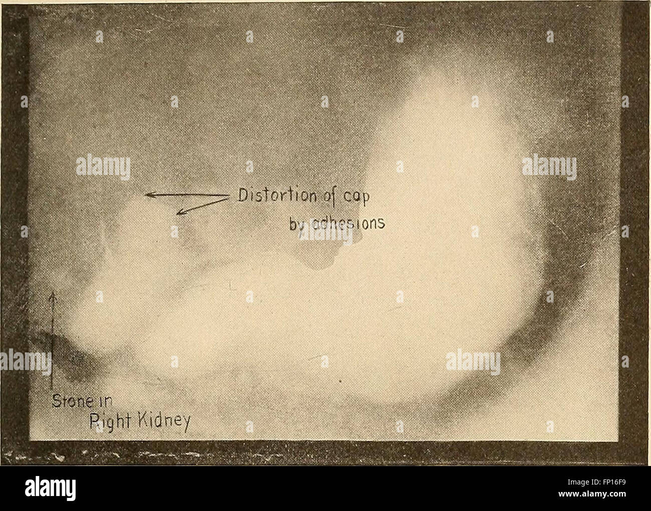 This 1917 manual provides a comprehensive guide to X-ray technology ...