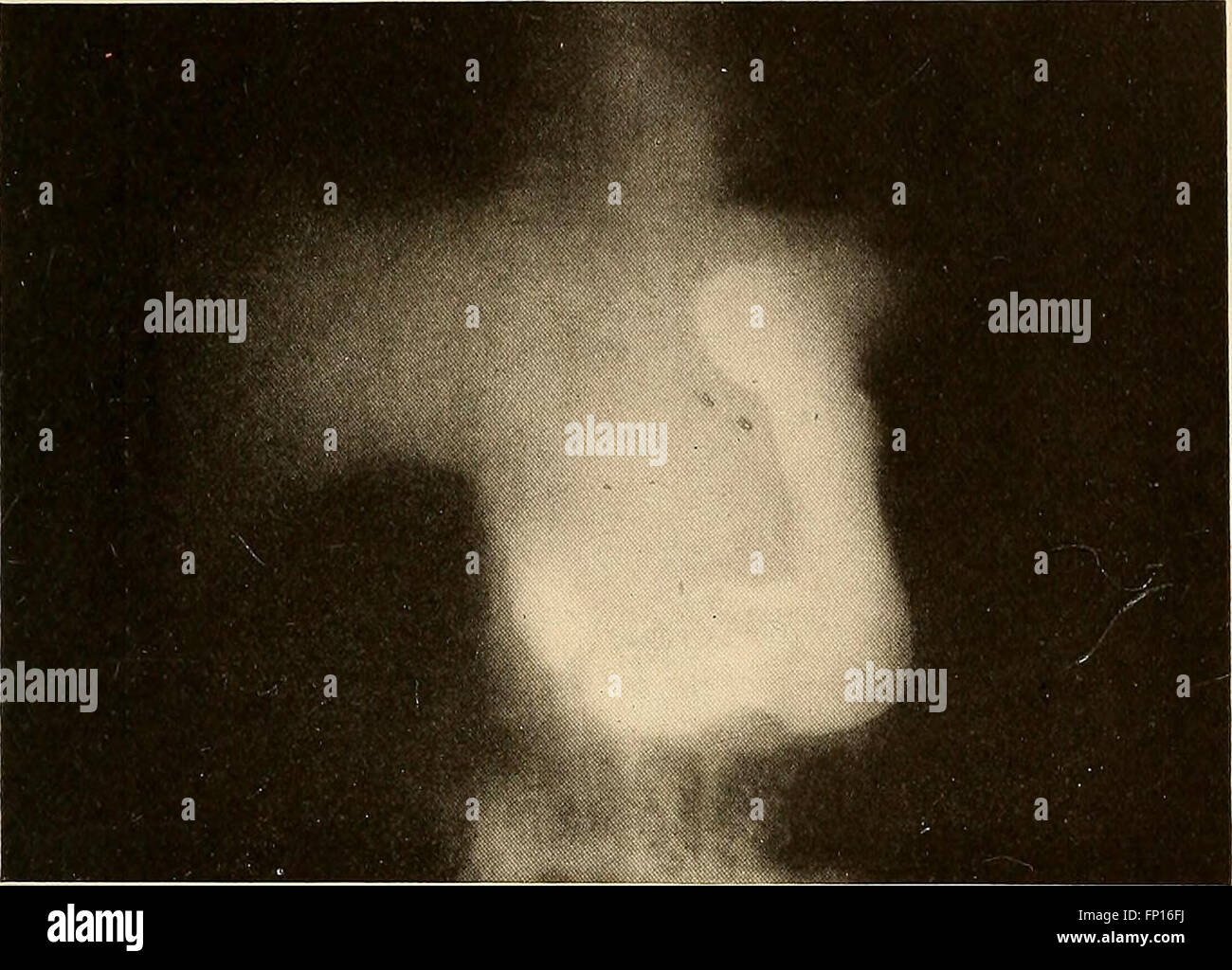 *A Manual of X-Ray Technic* (1917) provides detailed instructions on ...