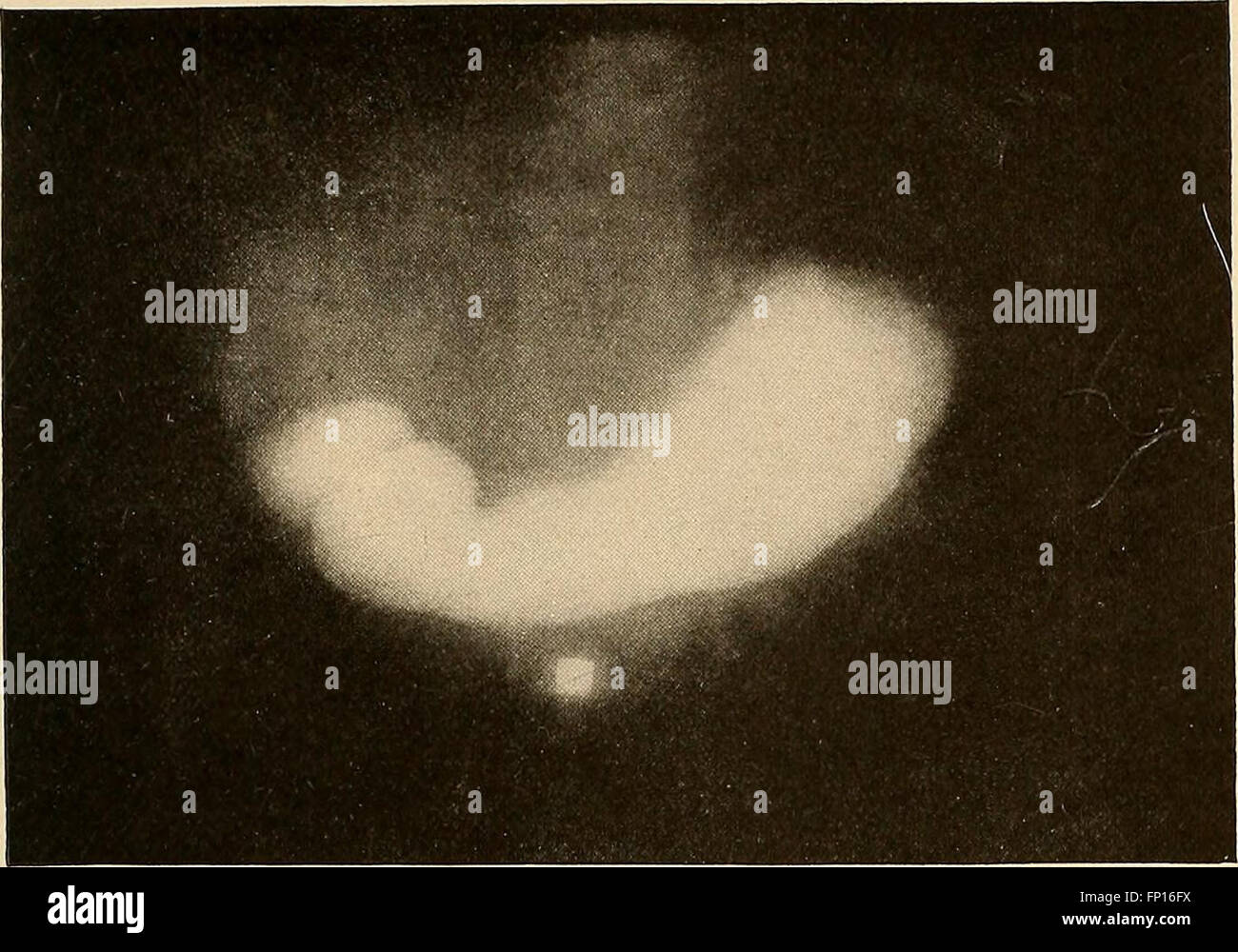 This 1917 manual provides guidelines and instructions on the use of X ...